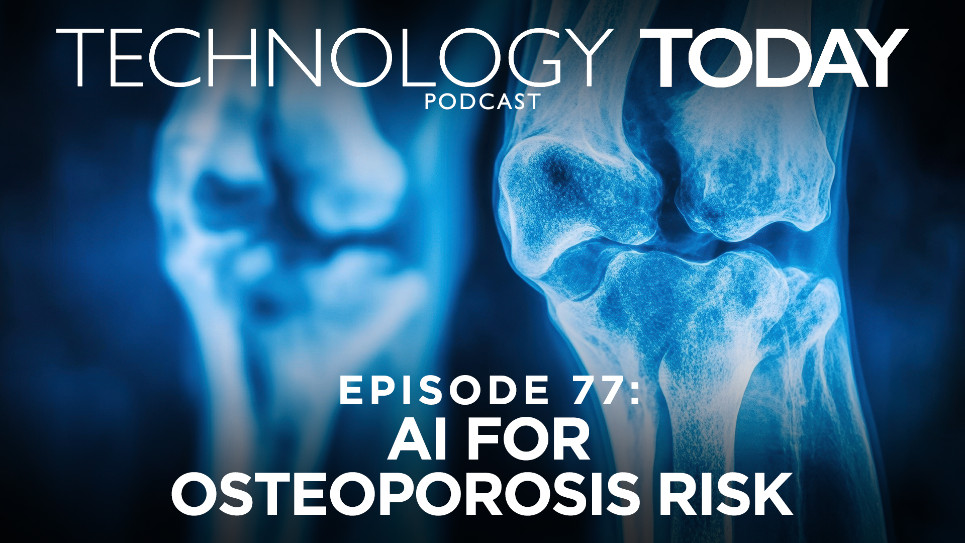 AI for Osteoporosis Risk | Southwest Research Institute